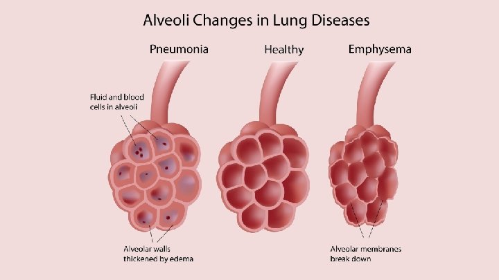 The lungs and breathing Learning objectives Define breathing