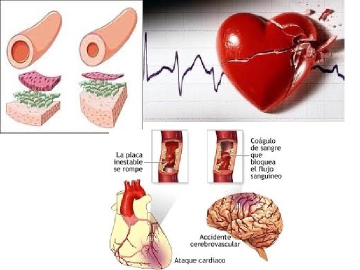 QUE ES l Es la presin que ejerce