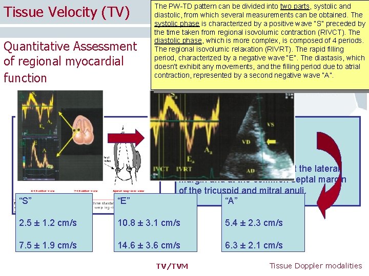 Introducing Tissue Doppler What is it TVTVM Definition