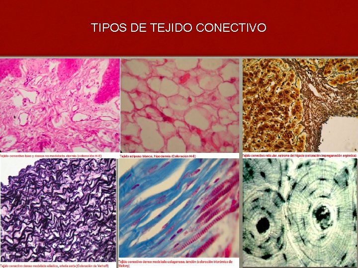 EL TEJIDO CONECTIVO UN SISTEMA DE COMUNICACIN Tcnicas