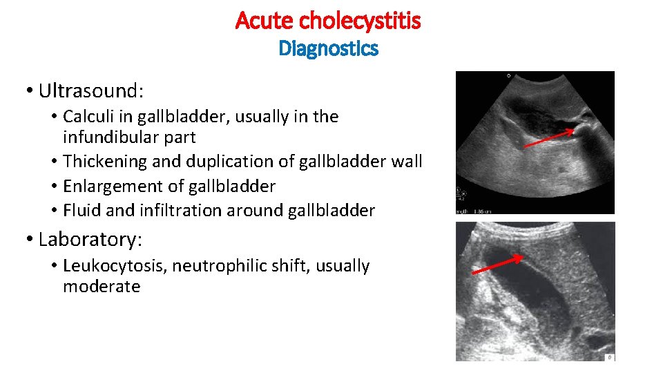 Acute abdomen Dr Malynovskyi A V Prof Dr