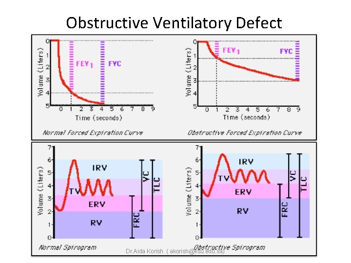 Respiratory ventilation Dr Aida Korish akorishksu edu sa