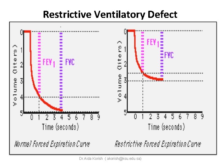 Respiratory ventilation Dr Aida Korish akorishksu edu sa
