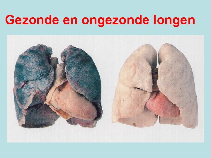 Verbranding en ademhaling Gezonde en ongezonde longen BS