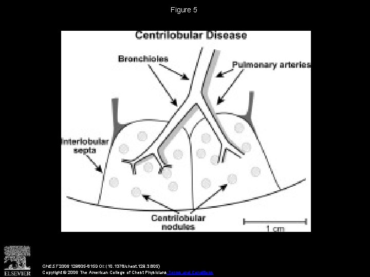 Pictorial Essay Multinodular Disease Raoof Suhail MD FCCP