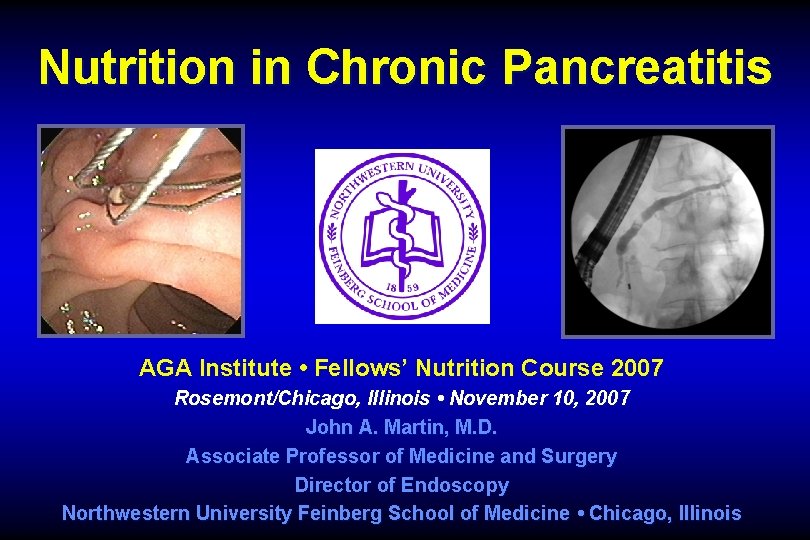 Nutrition in Chronic Pancreatitis AGA Institute Fellows Nutrition