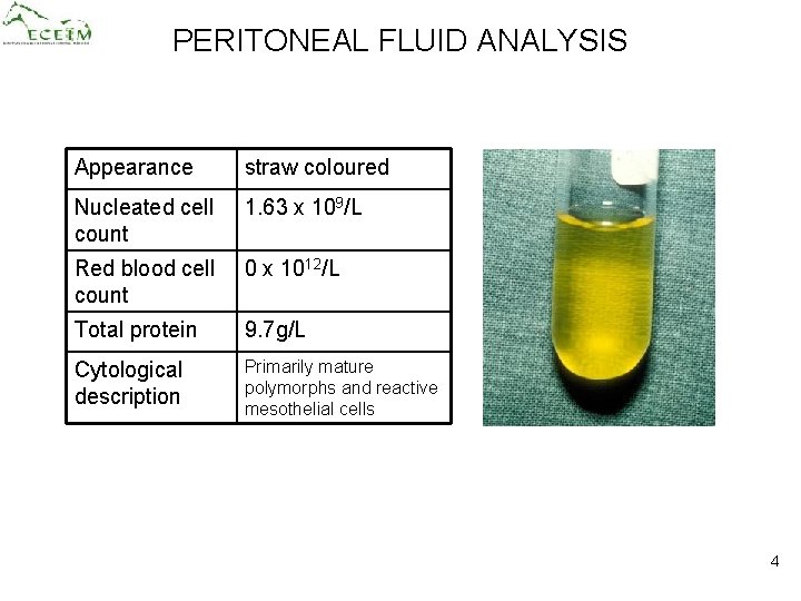 CASE B HISTORICAL FINDINGS AND PRESENTING SIGNS 4