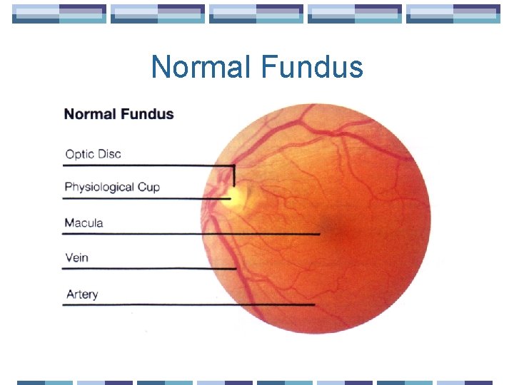 What is funduscopy And Why is it important