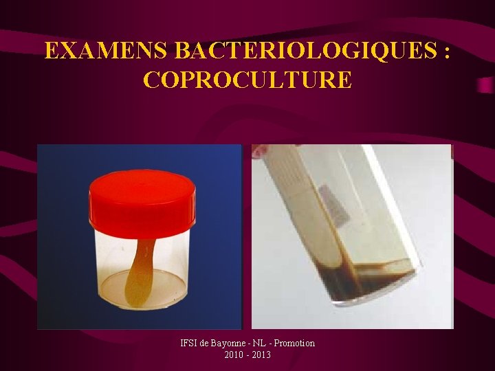 EXAMENS BIOLOGIQUES ET BACTERIOLOGIQUES DE DETECTION DUN AGENT