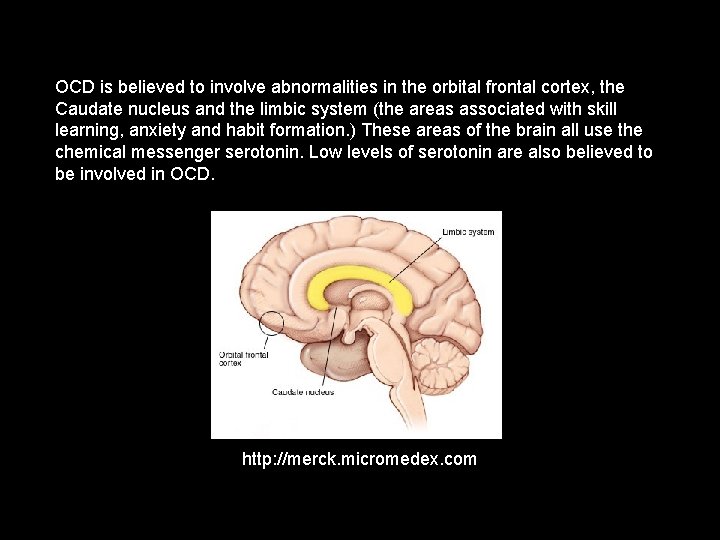 Bettina Pfeiffer WHAT IS OCD Obsession a thought