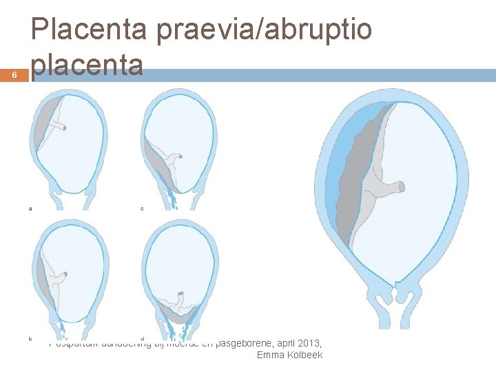 AANDOENINGEN TIJDENS EN VLAK NA DE BEVALLING Bij