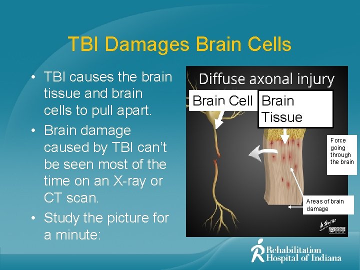 Webinar 1 What is a Brain Injury These