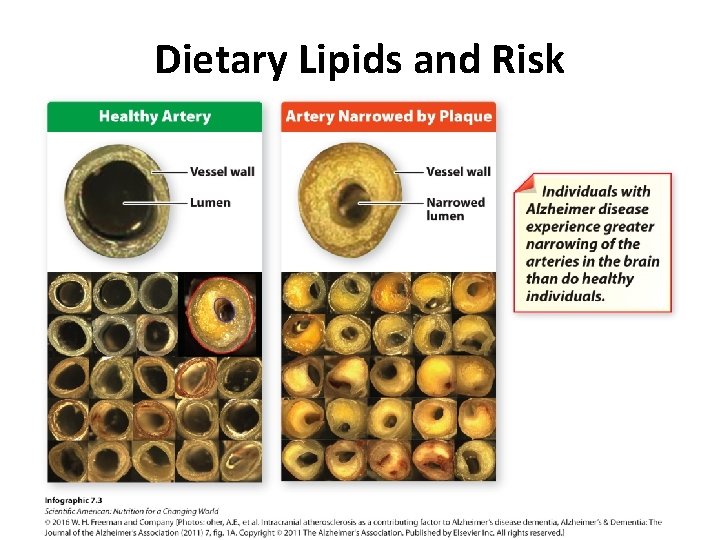 Chapter 7 LIPIDS IN HEALTH DISEASE Objectives Summarize