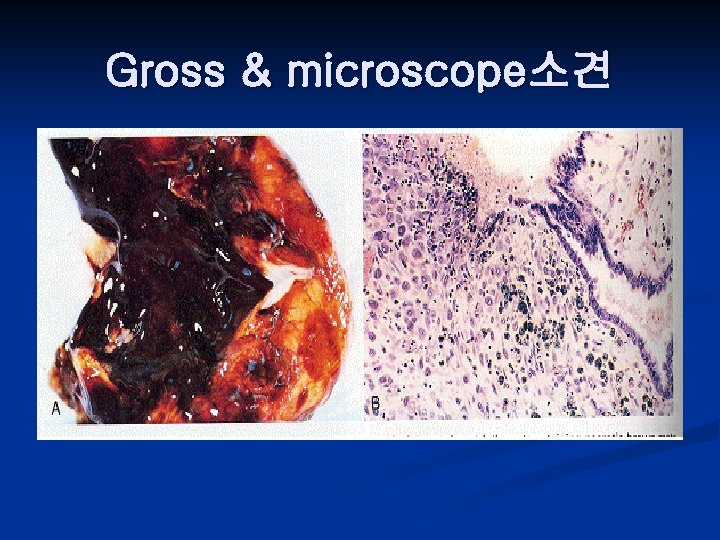 Case presentation PK 9 37 Identifying data Name
