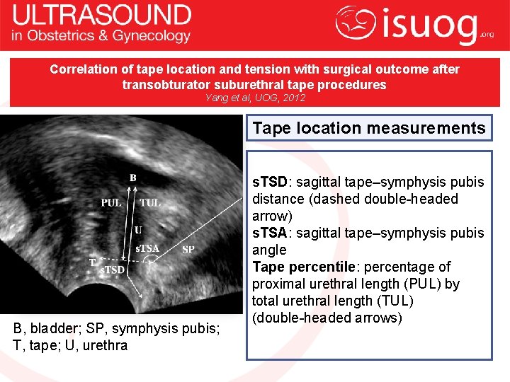 UOG Journal Club April 2012 Correlation of tape