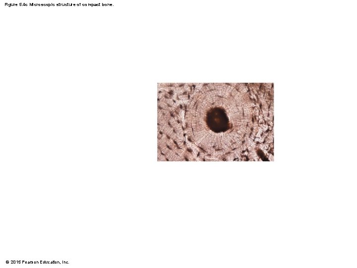 Figure 5 1 Flat bones consist of a