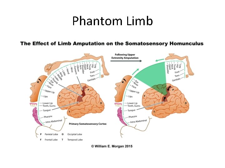 Phantom Limb Lesson to be given to Biology