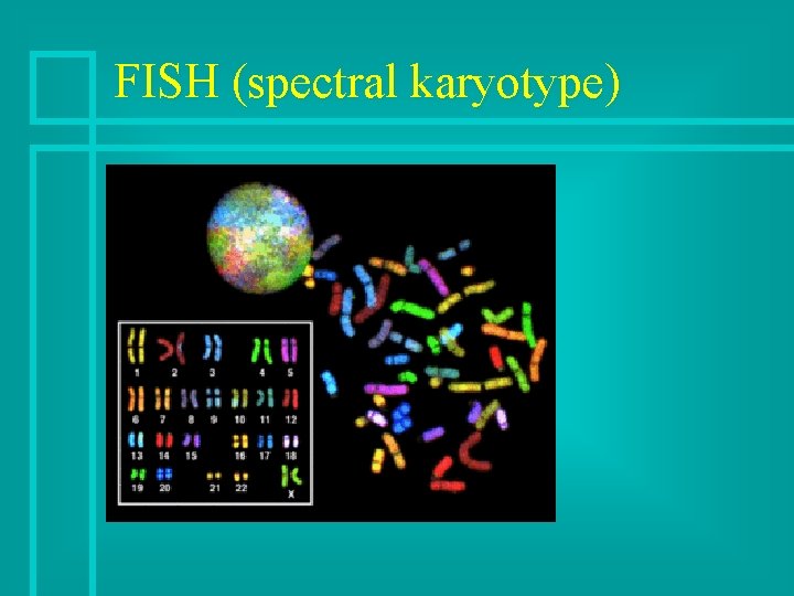 Karyotyping Preparing human chromosomes for observation History of