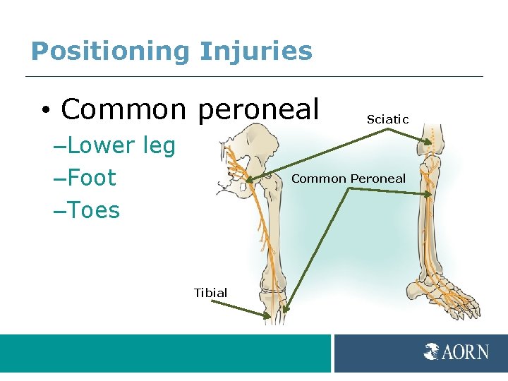 The Basics of Positioning Patients in Surgery Prevention