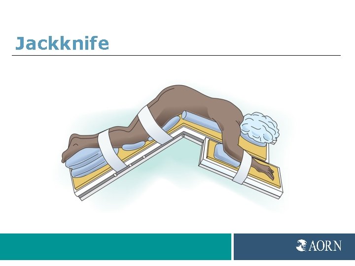 The Basics of Positioning Patients in Surgery Prevention