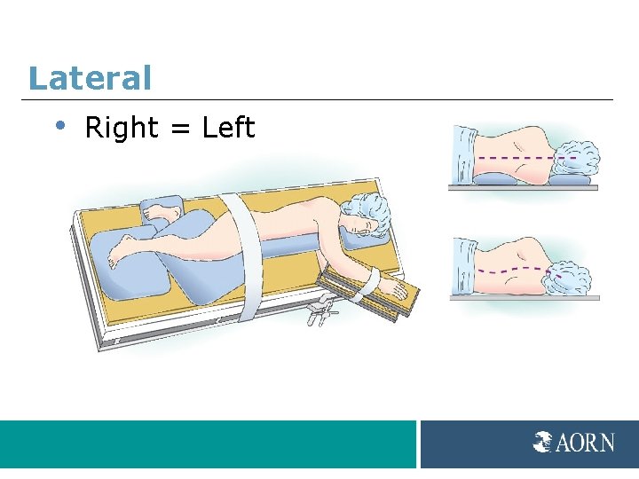 The Basics of Positioning Patients in Surgery Prevention