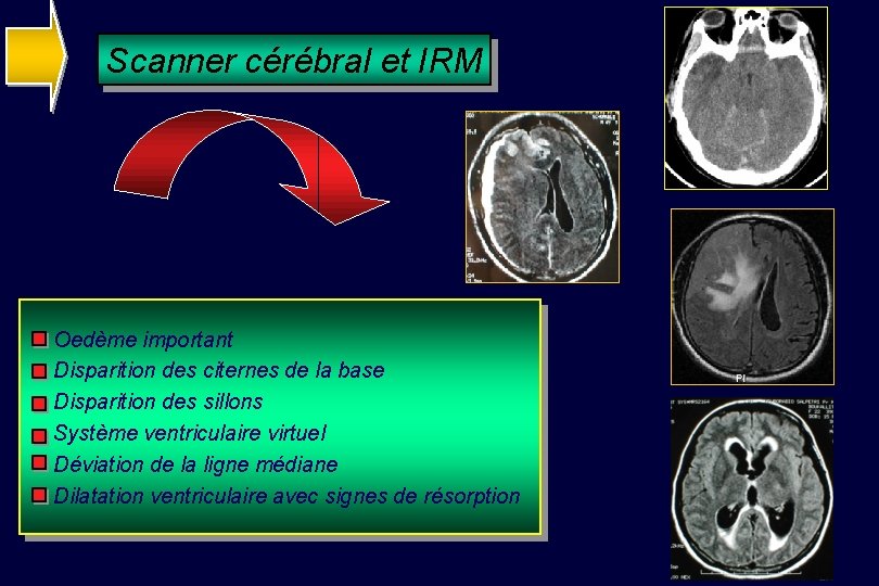 PRINCIPES D ANESTHESIE EN NEUROCHIRURGIE Dr Lamine ABDENNOUR