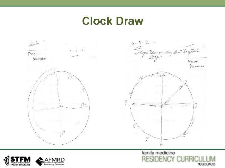 Delirium Pavithra Indramohan Elizabeth Mohan Learning Objectives At