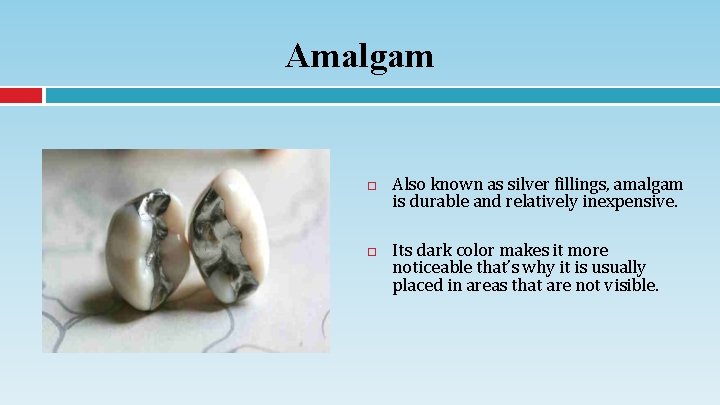 What You Need to Know About Dental Filling