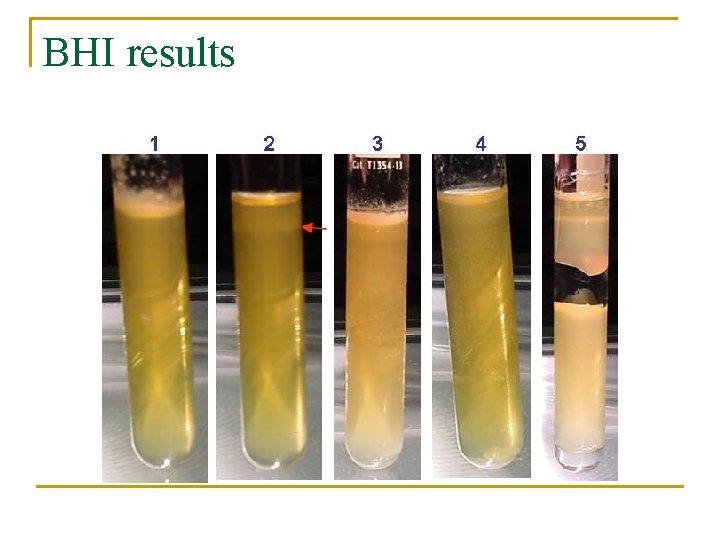 Bacterial Requirements Temperature and Oxygen Measurement of Microbial