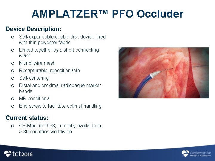 Longterm Comparison of Patent Foramen Ovale PFO Closure