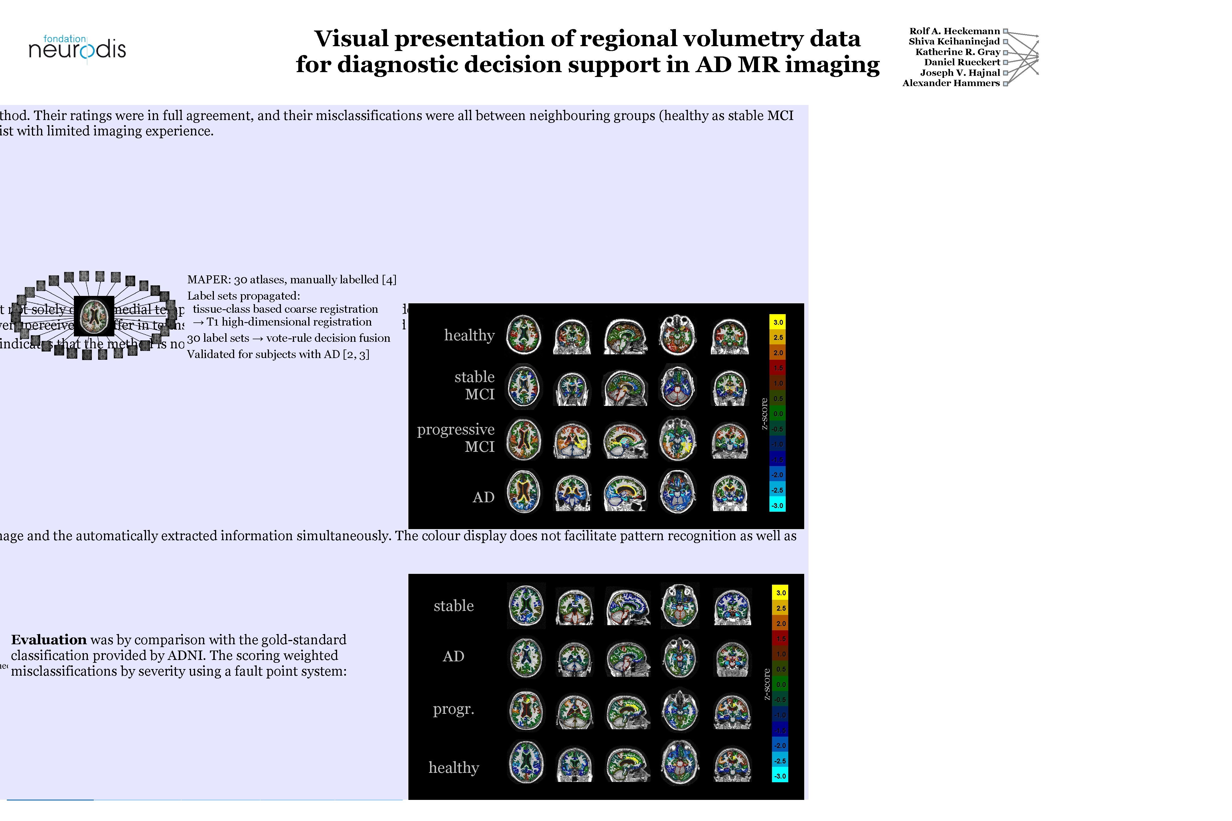 Visual presentation of regional volumetry data for diagnostic