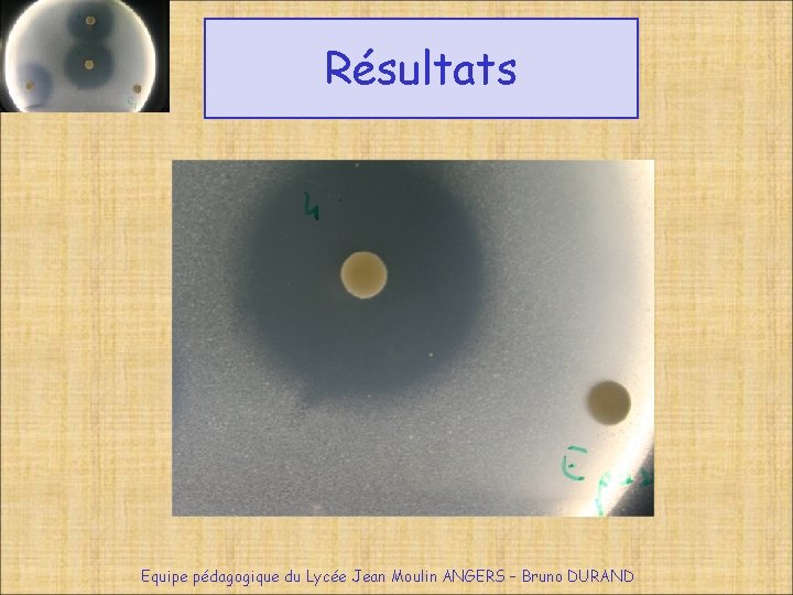 Antibiogramme par diffusion en milieu glos mthode des