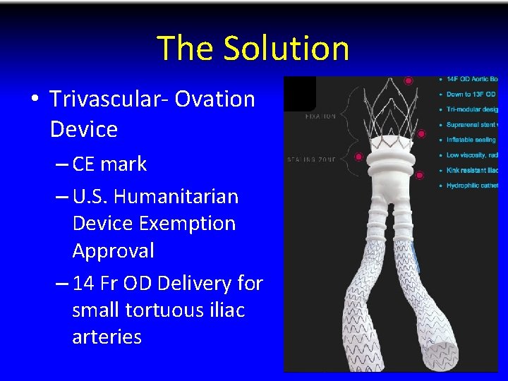 The Endospan Solution for AAA Jacob Cynamon MD