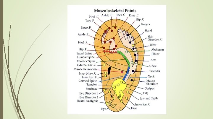 Battlefield Acupuncture BFA for Pain Relief Sioux Falls