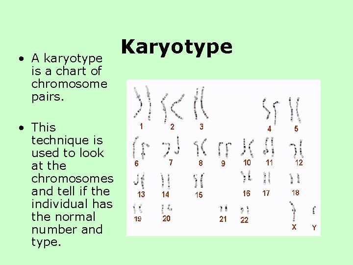 Mendelian Inheritance of Human Traits Simple Recessive Heredity