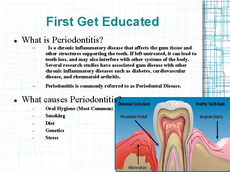 Periodontitis By Brooke Auger Periodontitis If you have