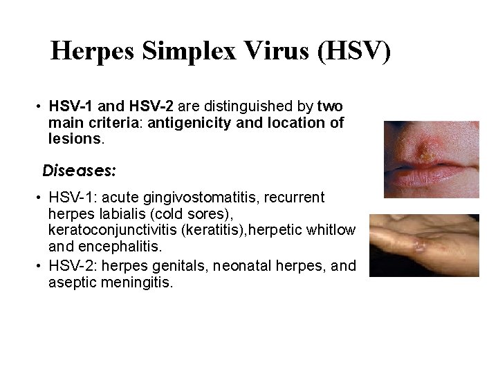 VIRAL SKIN INFECTIONS By Prof Dr Ghada Fahmy