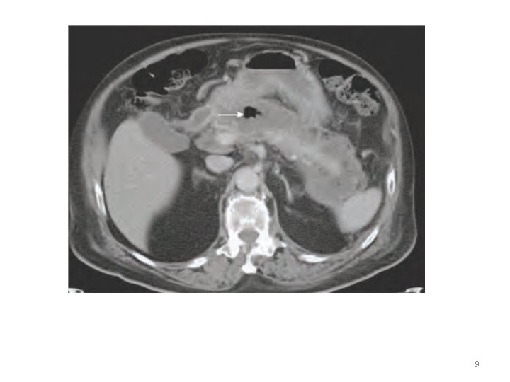 Pancreas part 2 By Dr Ali Adil 1
