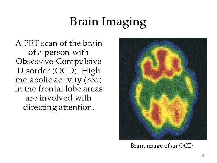 Unit 11 Abnormal Psychology Day 3 Mood Disorders