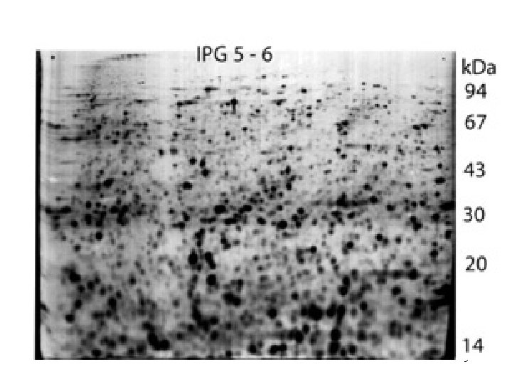 Balanced Translocation detected by FISH 1 Red Chrom