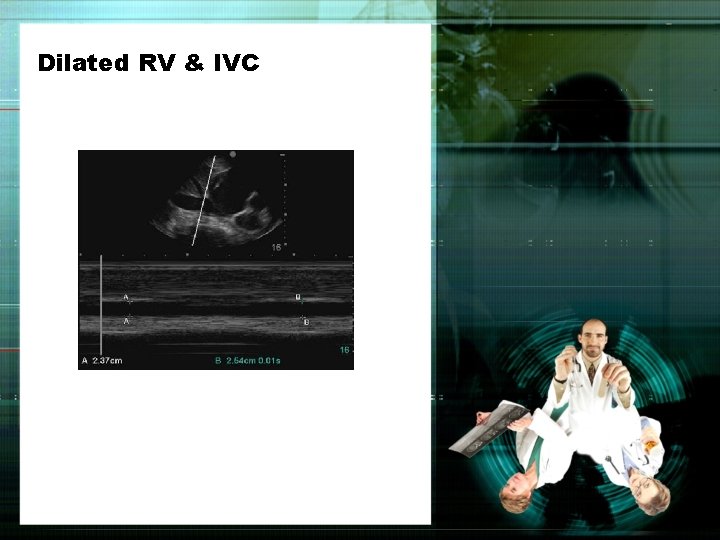 ADULT ECHOCARDIOGRAPHY Lesson Nine Valvular Heart Disease Harry