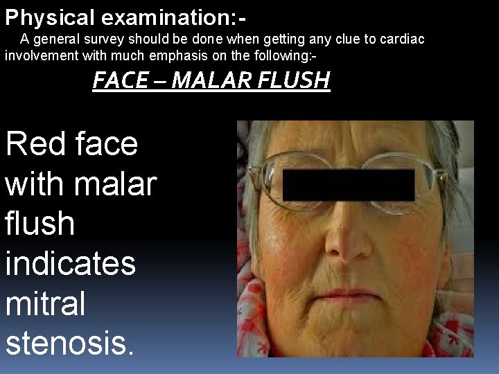 CASE TAKING IN CARDIO VASCULAR CONCERN By Dr