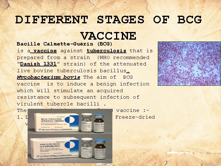 DIFFERENT STAGES OF BCG VACCINE BY MBBSPPT COM
