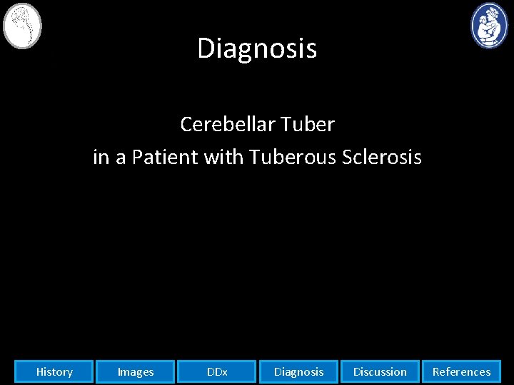 4 yearold boy with Tuberous Sclerosis and an
