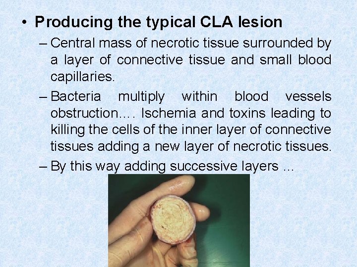 CASEOUS LYMPHADENITIS CLA Other names PSEUDOTUBERCULOSIS CHEESY GLANDS