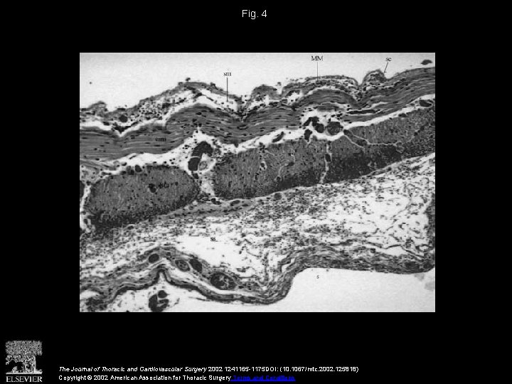Small intestine without mucosa as a growing vascular