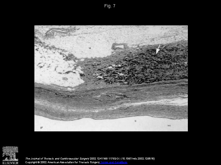 Small intestine without mucosa as a growing vascular