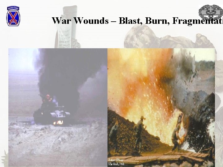 BURNS War Wounds Blast Burn Fragmentati OVERVIEW Structure
