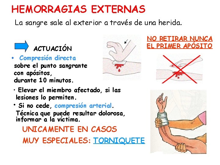 HEMORRAGIAS DEFINICIN TIPOS DE HEMORRAGIA ACTUACIN FREMAP HEMORRAGIAS