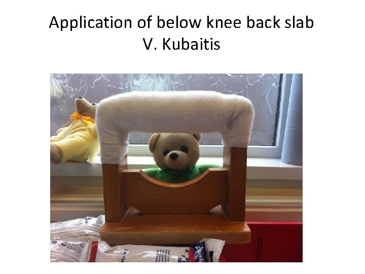 Application of below knee back slab V Kubaitis